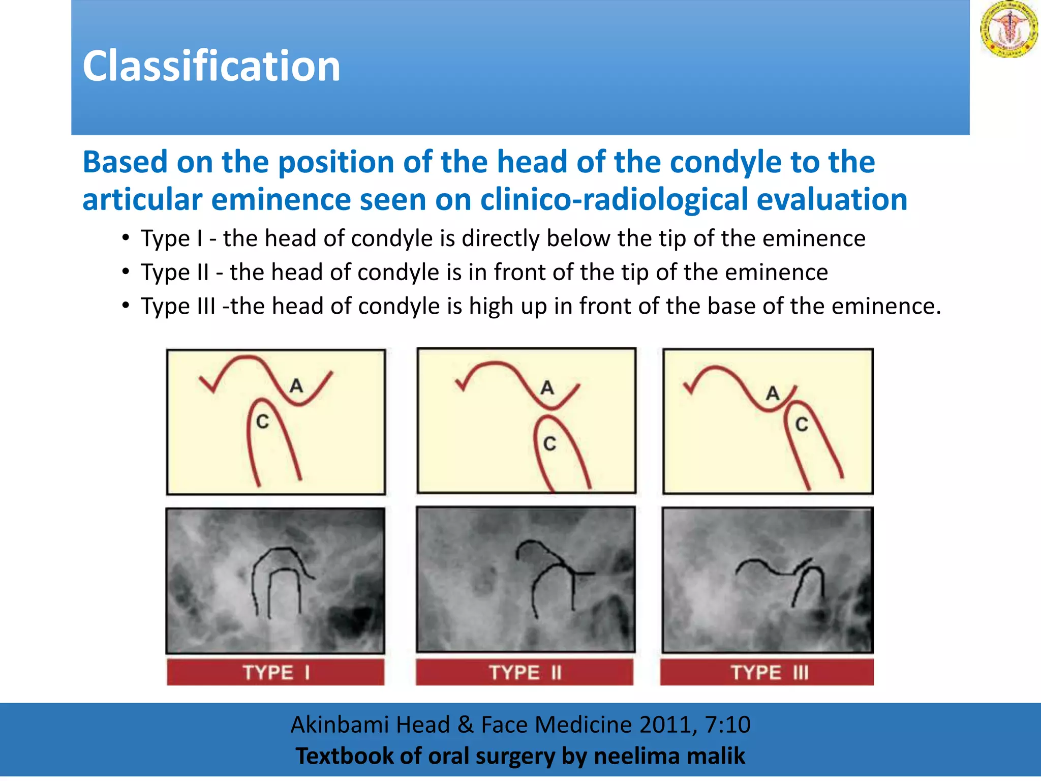 Temporomandibular joint dislocation | PPTX