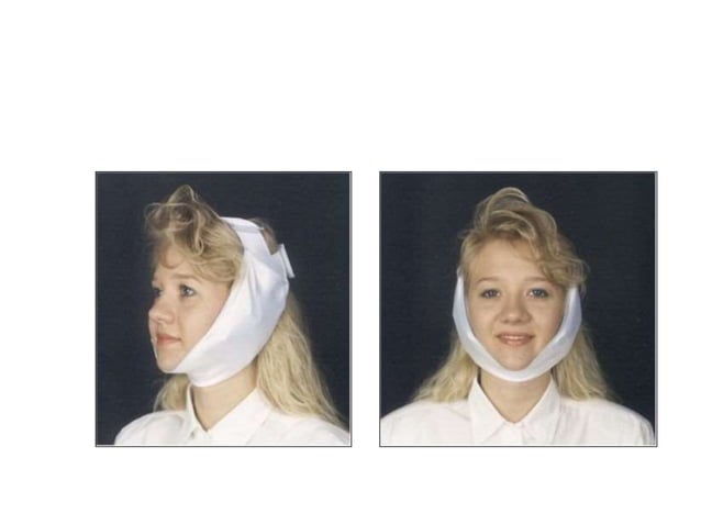 Temporomandibular Joint Dislocation Pptx