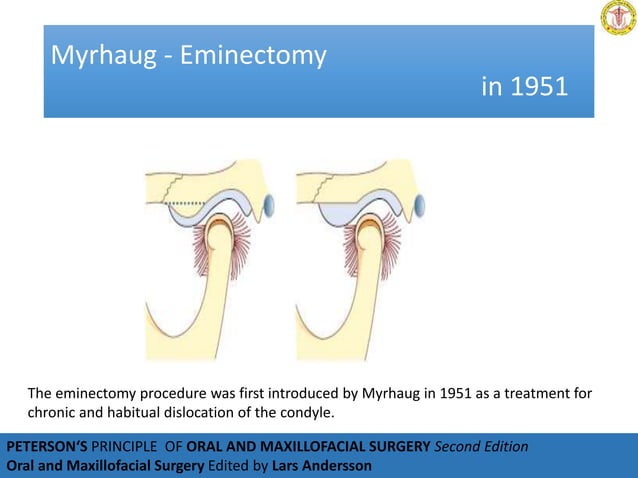 Temporomandibular Joint Dislocation Pptx