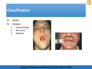 Temporomandibular joint dislocation | PPTX