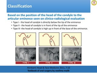 Temporomandibular joint dislocation | PPTX