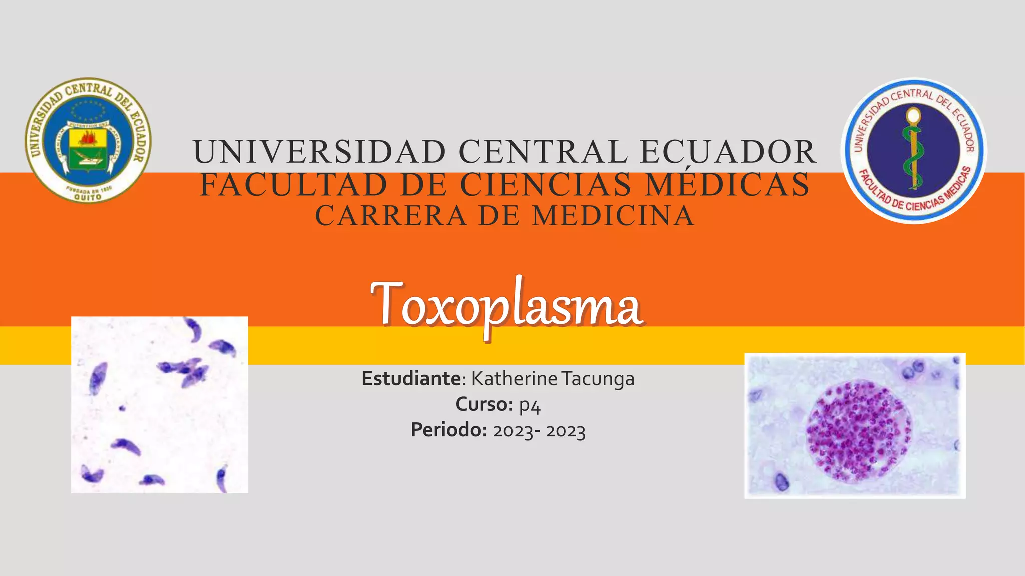 8 TOXOPLASMA GONDII 21.pptx