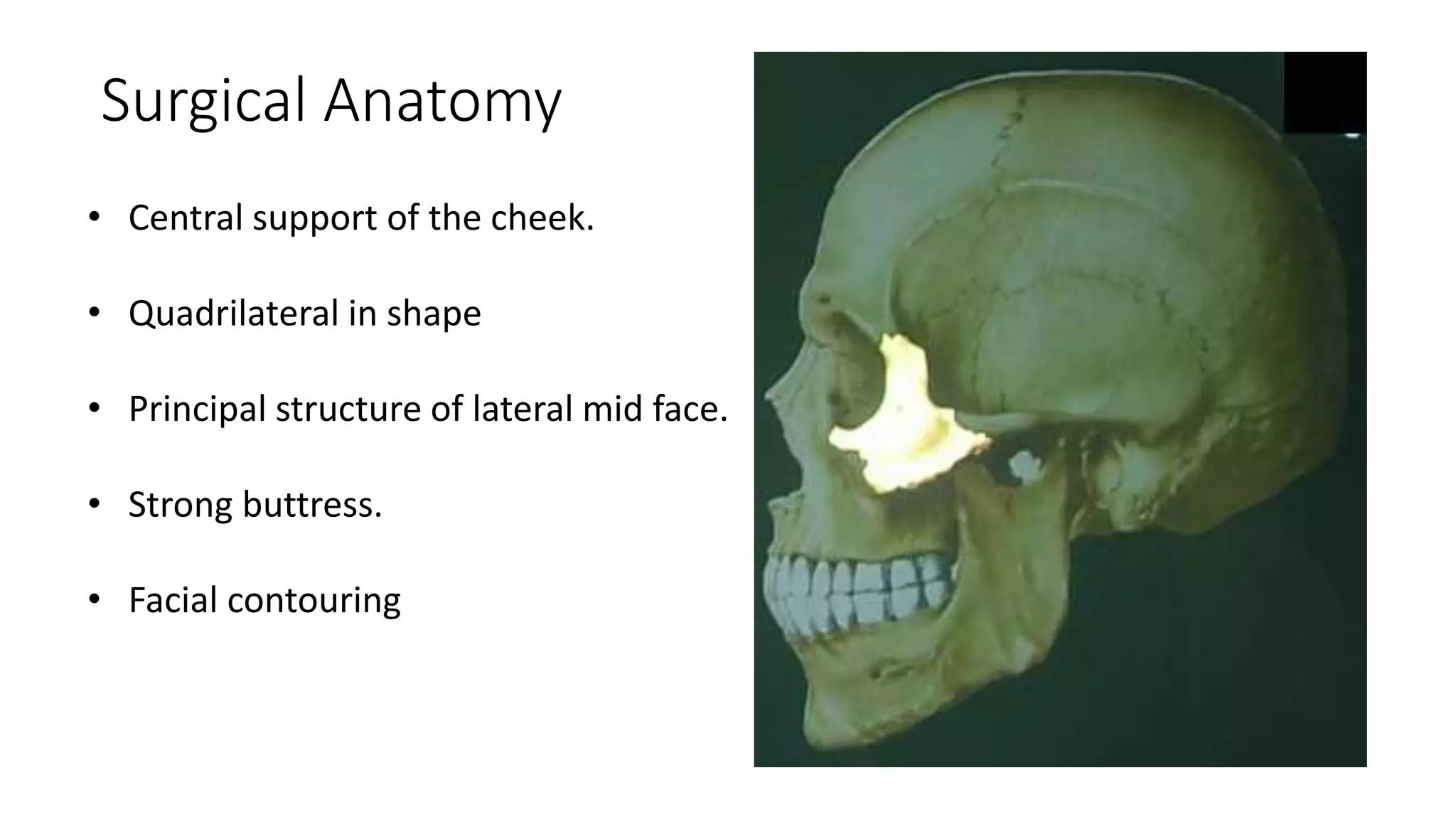 Zygomatico Maxillary Complex Fractures.pptx | Death, Injury, or ...