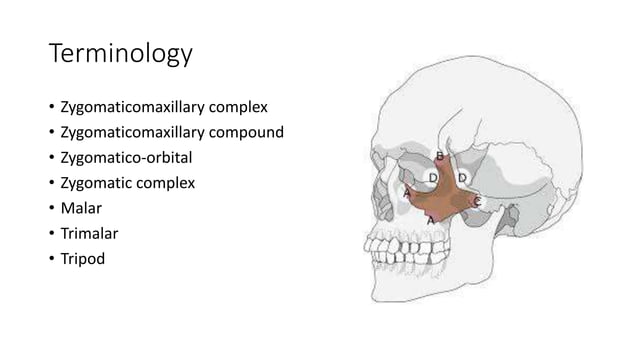 Zygomatico Maxillary Complex Fractures.pptx | Death, Injury, or ...