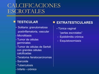 9. ecografia de testiculo y escroto | PPT