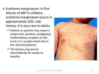 Erythema Marginatum Rheumatic Fever