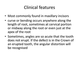 9.dilaceration | PPTX