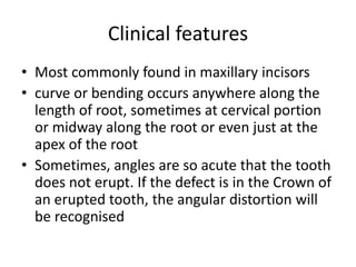9.dilaceration | PPTX