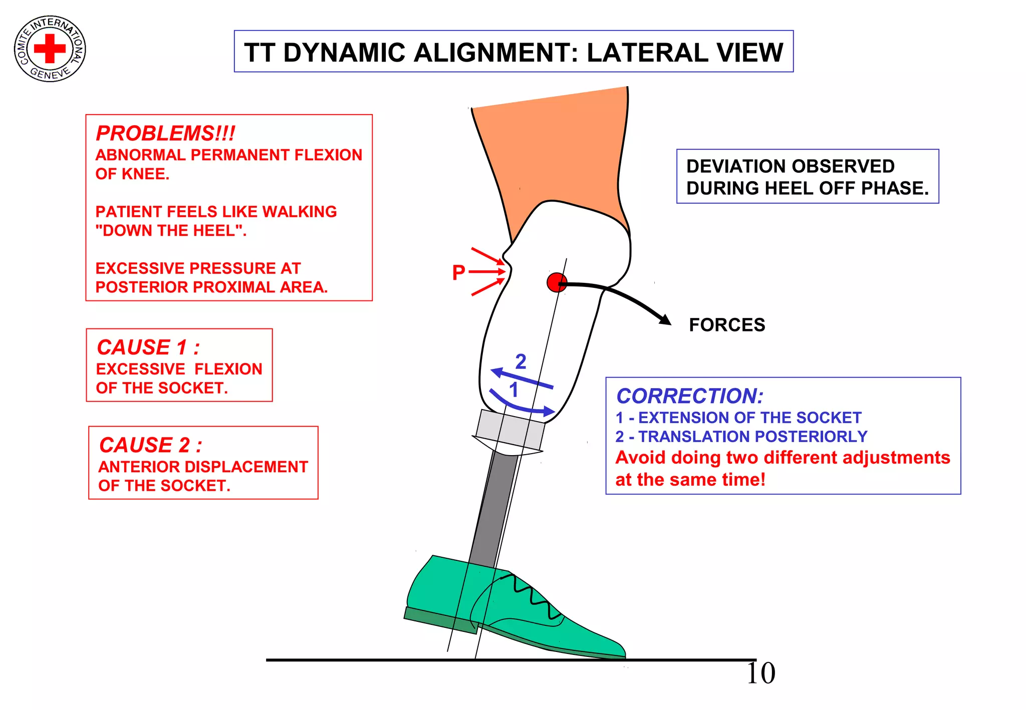 Transtibial Dynamic Alignment | PPT