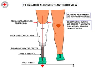 Transtibial Dynamic Alignment | PPT