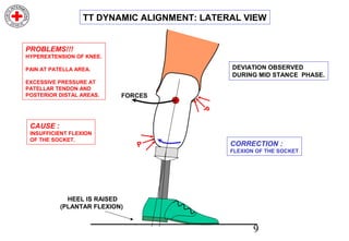Transtibial Dynamic Alignment | PPT