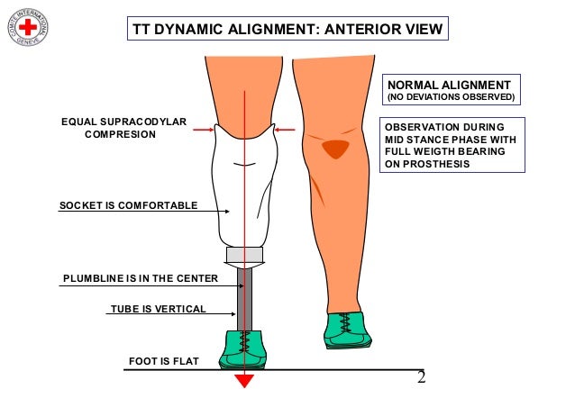 Transtibial Dynamic Alignment