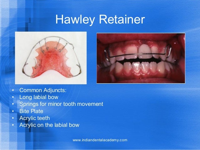 orthodontic finishing and retention
