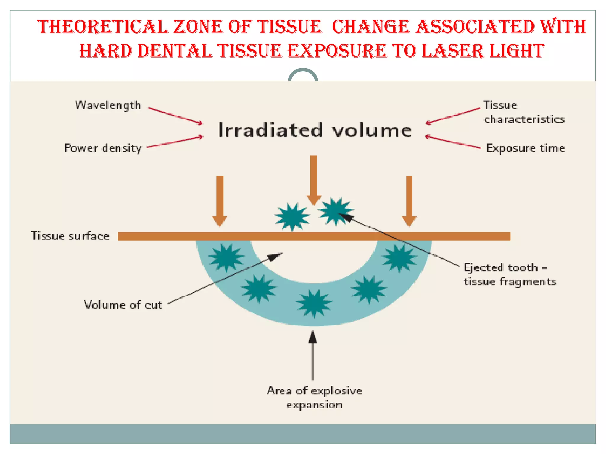 Lasers and its application in periodontics | PPT