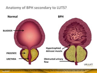 ECO10 - Measuring the true pathway of innovation in the NHS | PPT