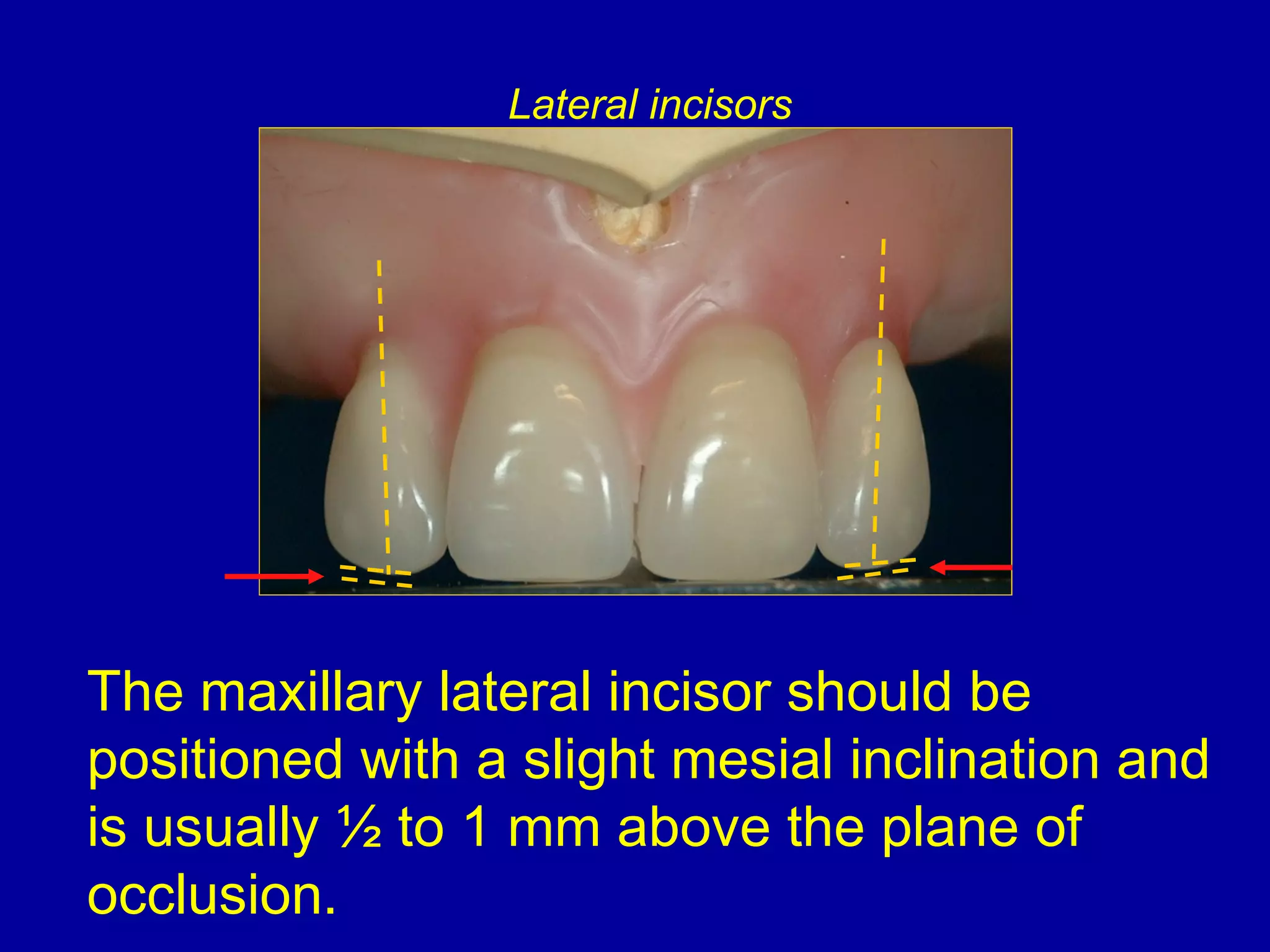 9. anterior teeth arrangement | PPT