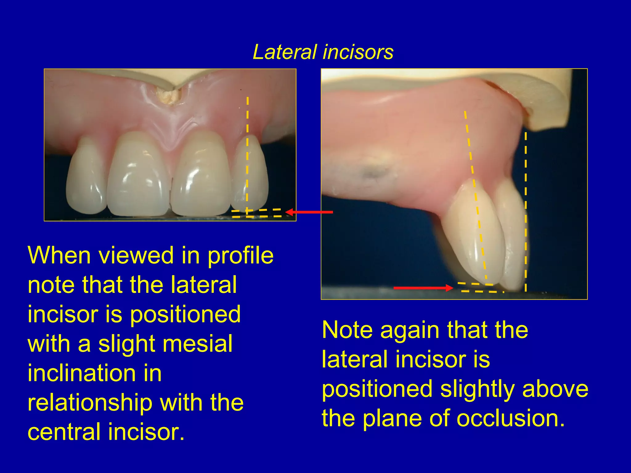 9. anterior teeth arrangement | PPT