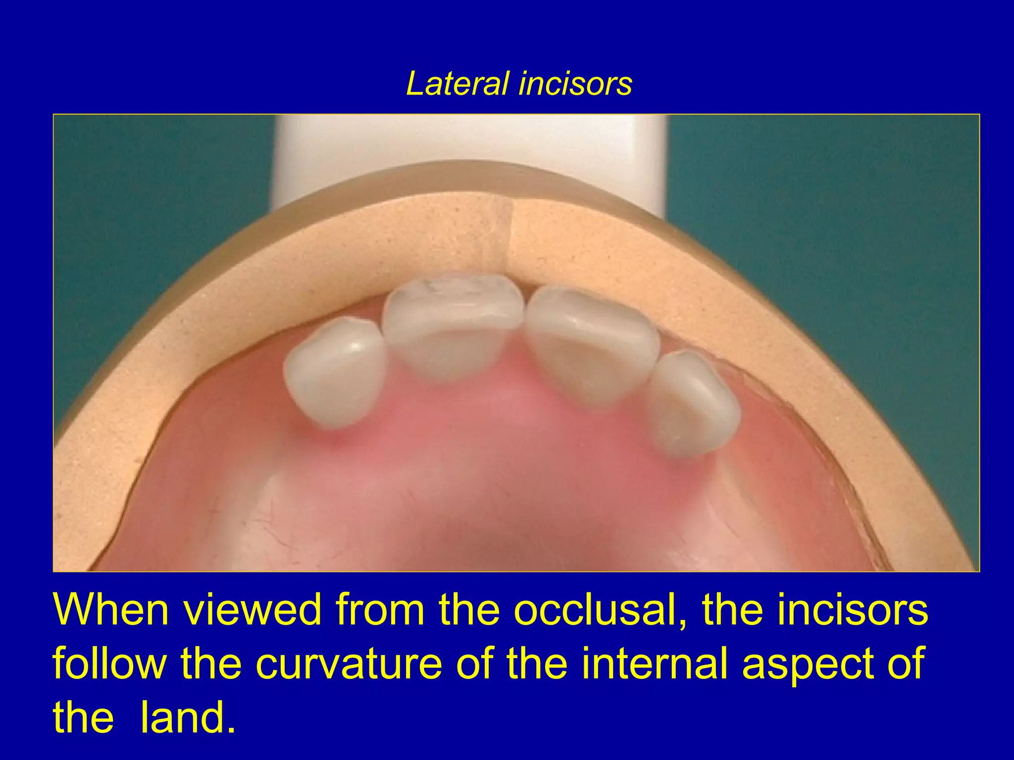 9. anterior teeth arrangement | PPT