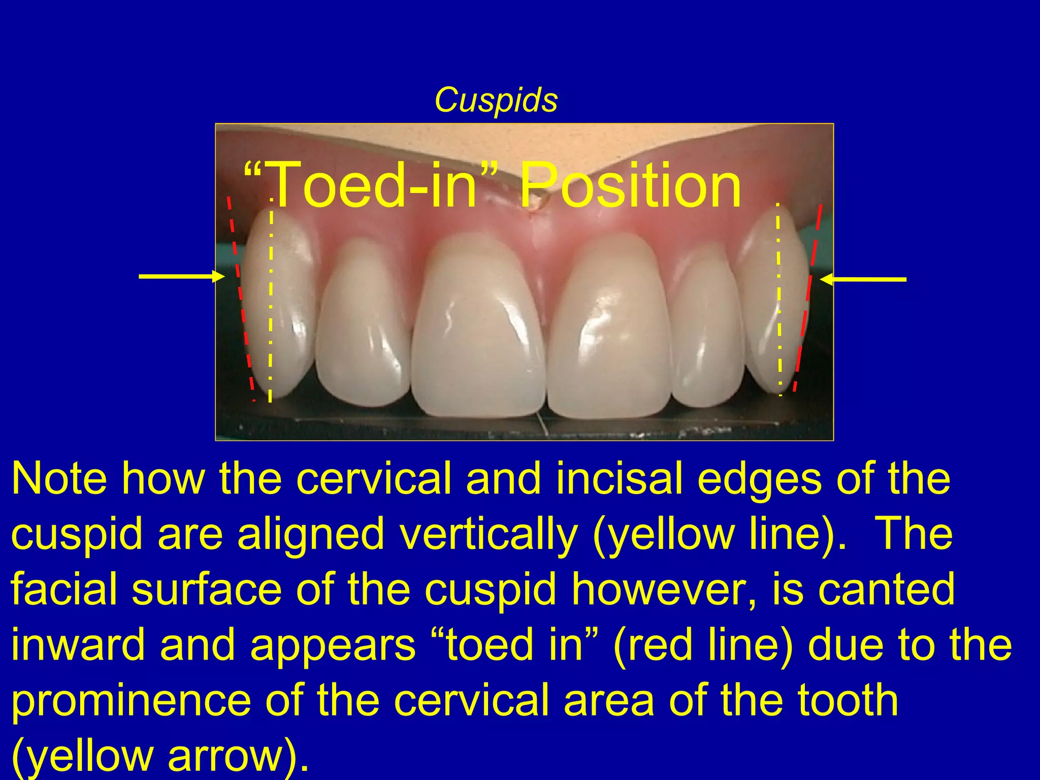 9. anterior teeth arrangement | PPT
