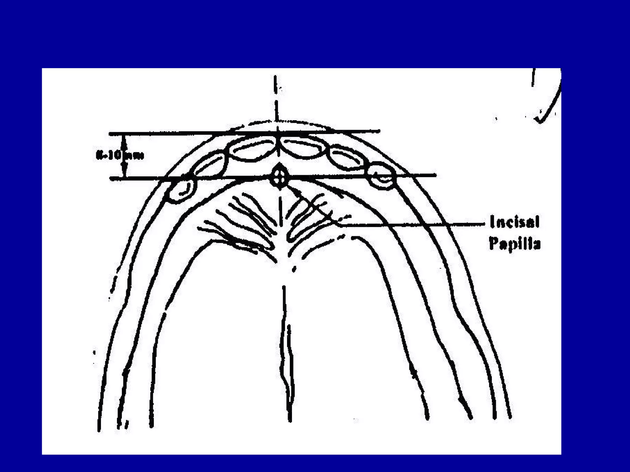 9. anterior teeth arrangement | PPT
