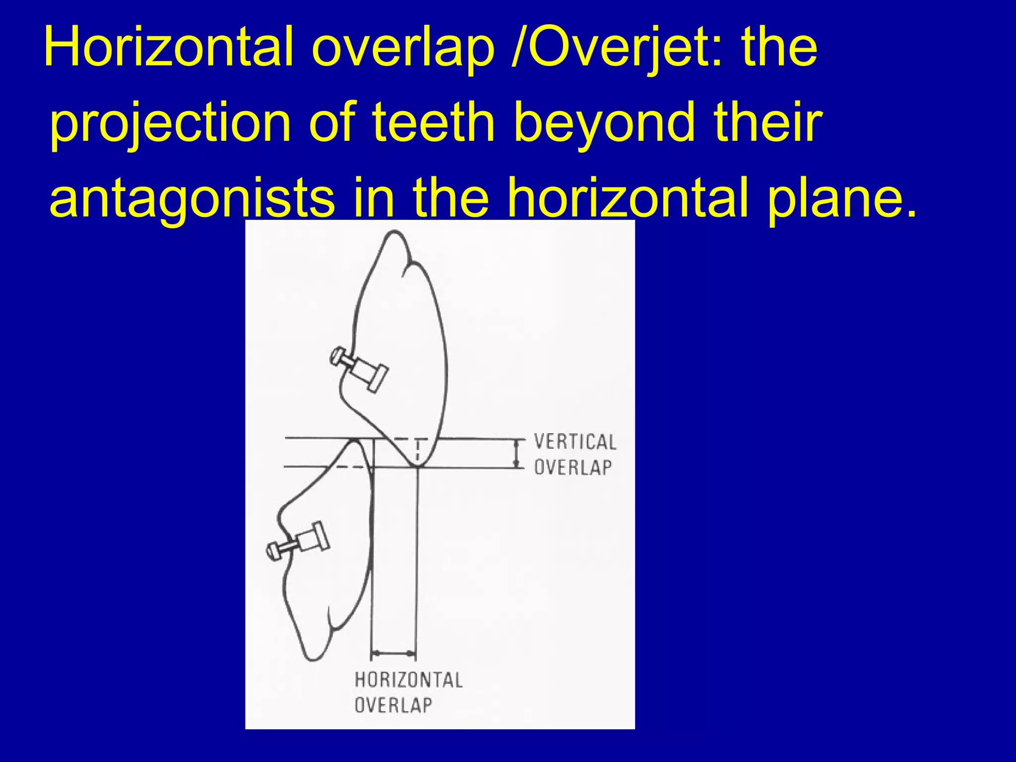 9. anterior teeth arrangement | PPT