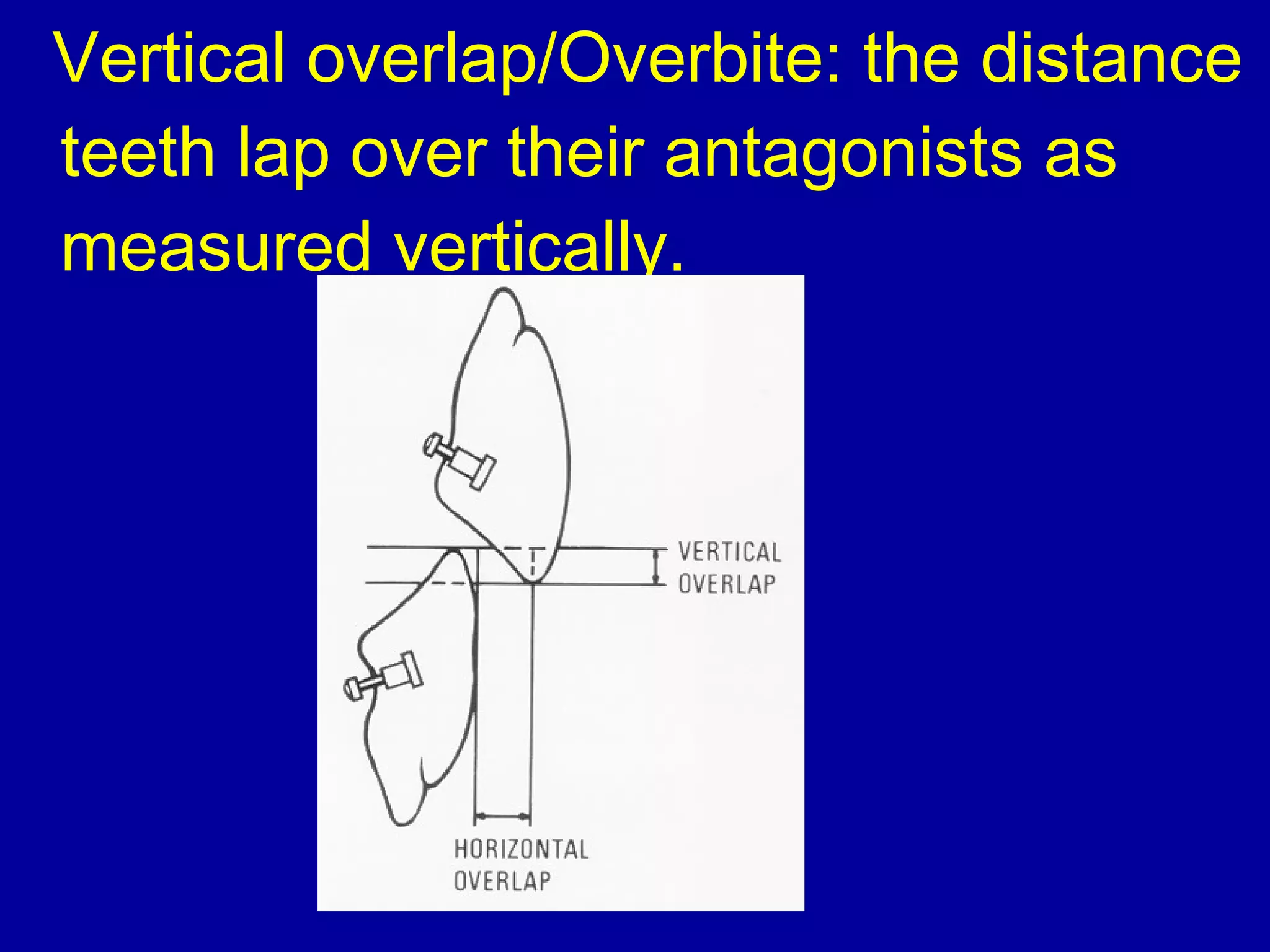 9. anterior teeth arrangement | PPT