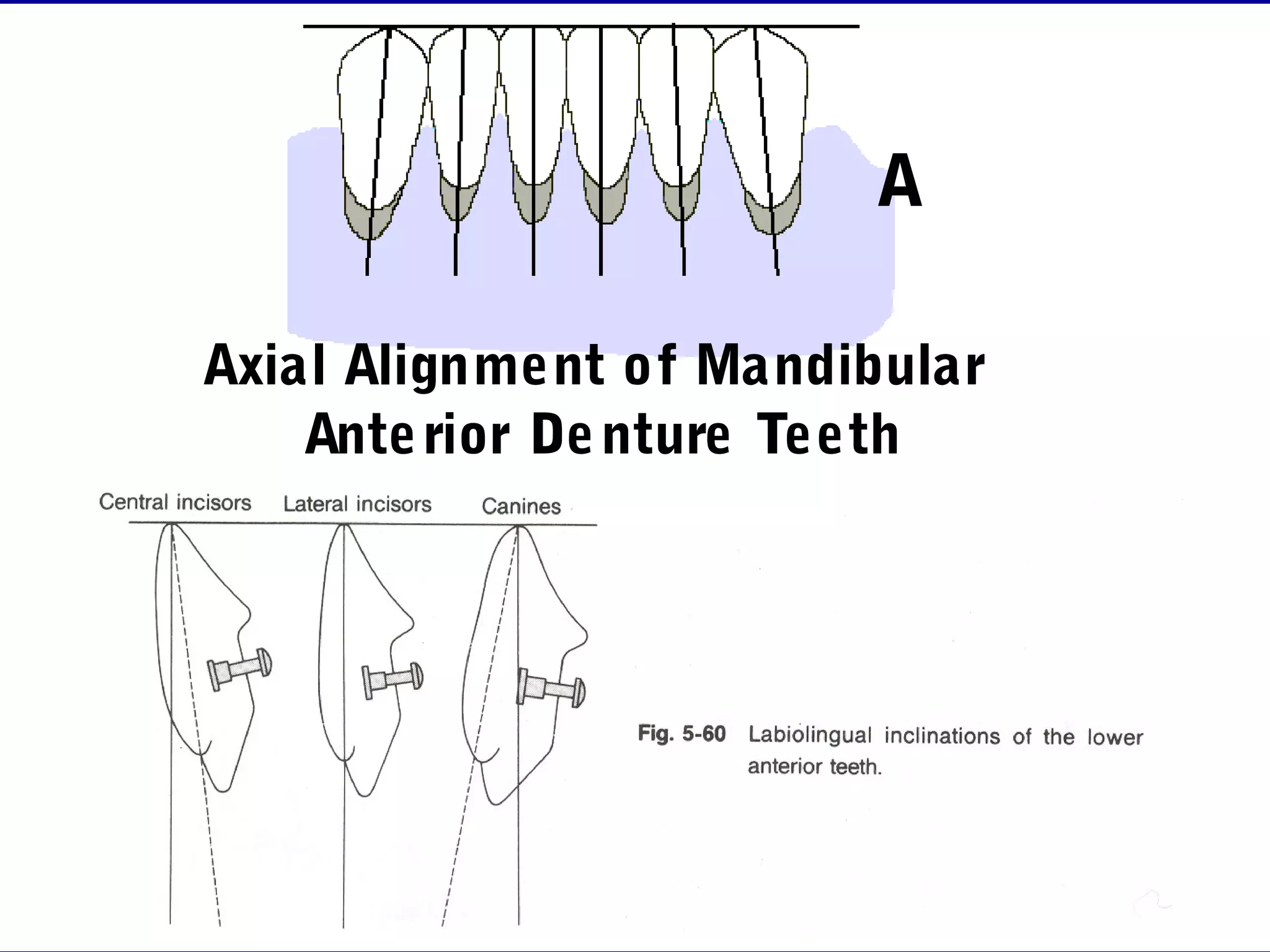 9. anterior teeth arrangement | PPT