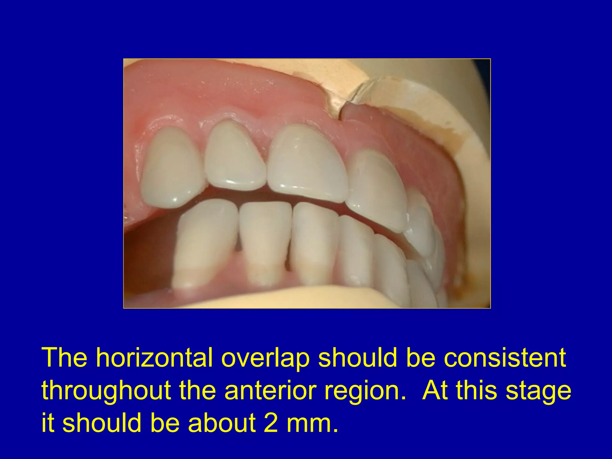 9. anterior teeth arrangement | PPT