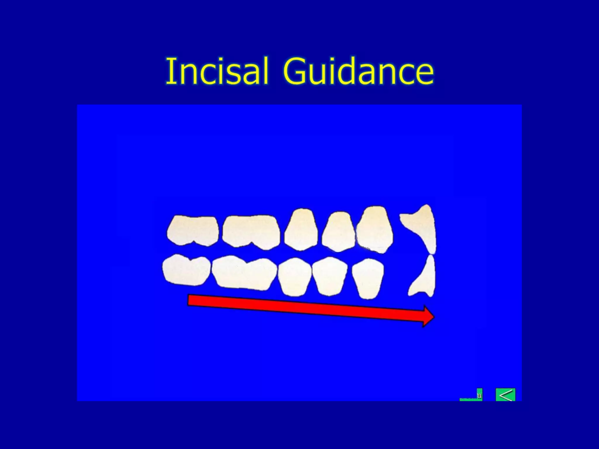 9. anterior teeth arrangement | PPT