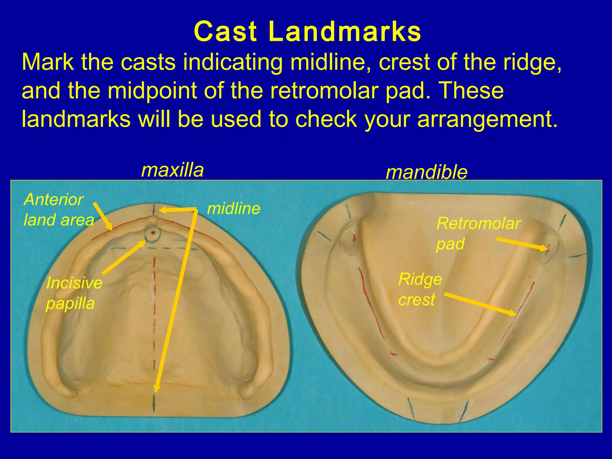 9. anterior teeth arrangement | PPT