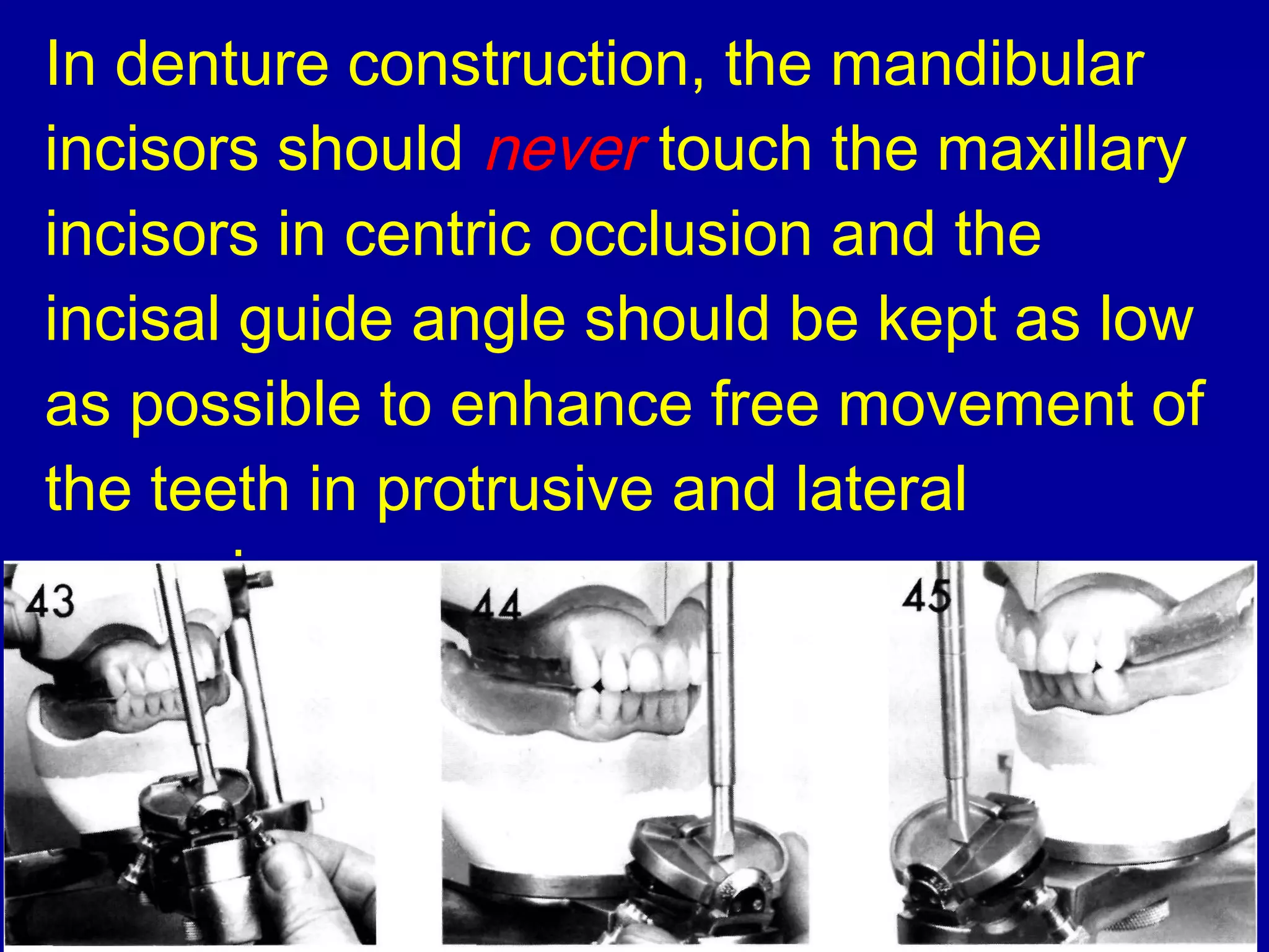 9. anterior teeth arrangement | PPT