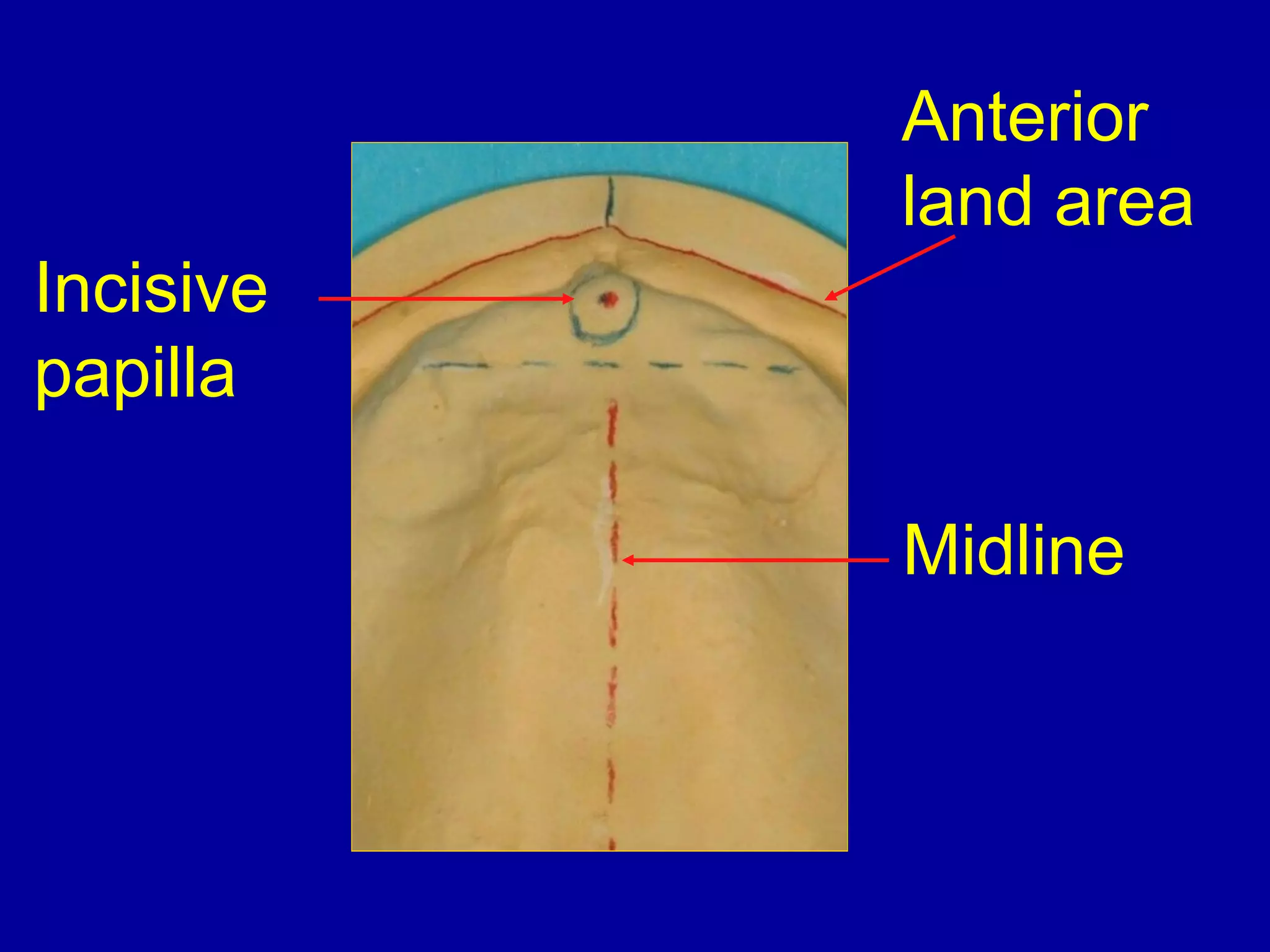 9. anterior teeth arrangement | PPT