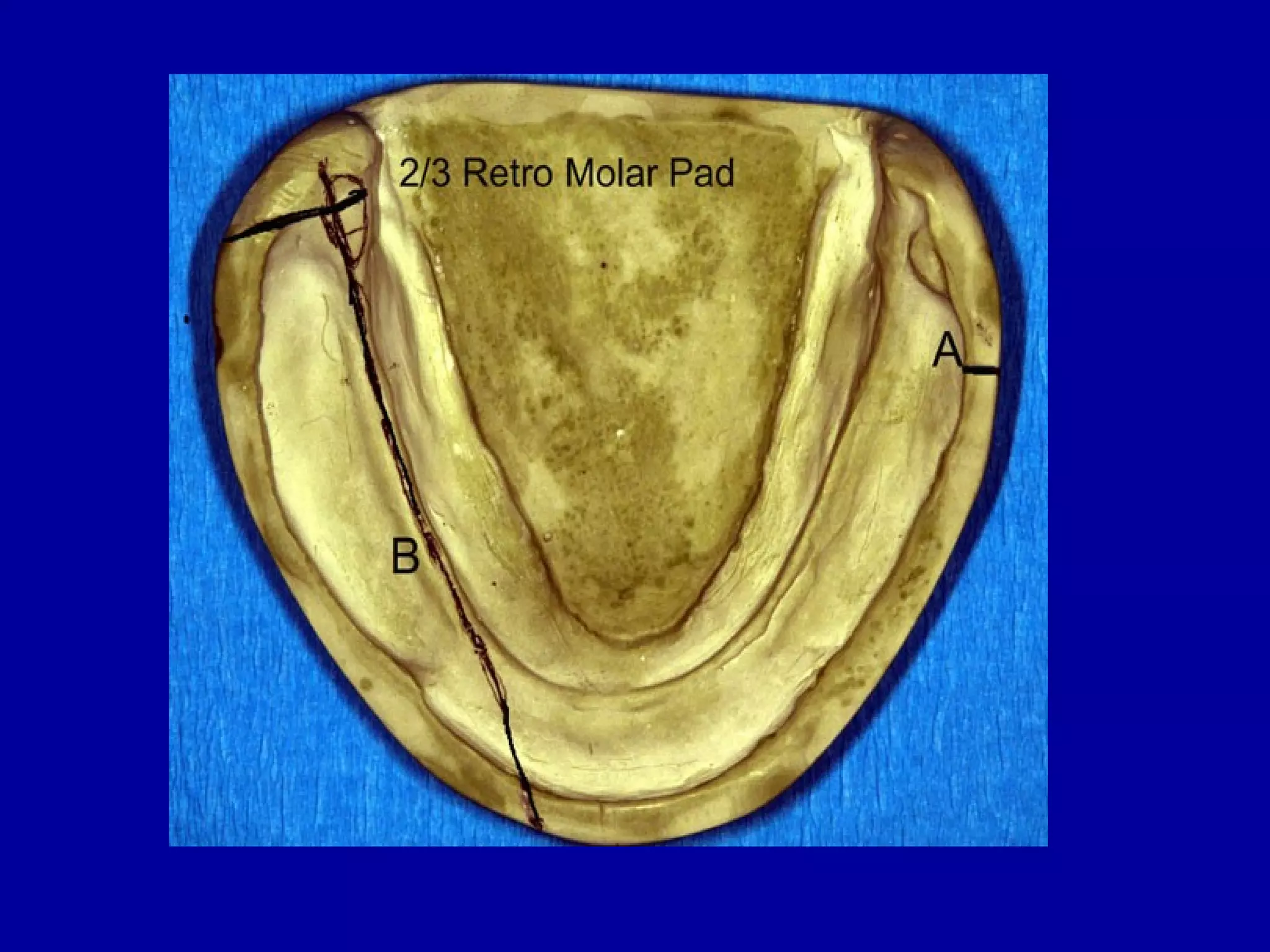 9. anterior teeth arrangement | PPT