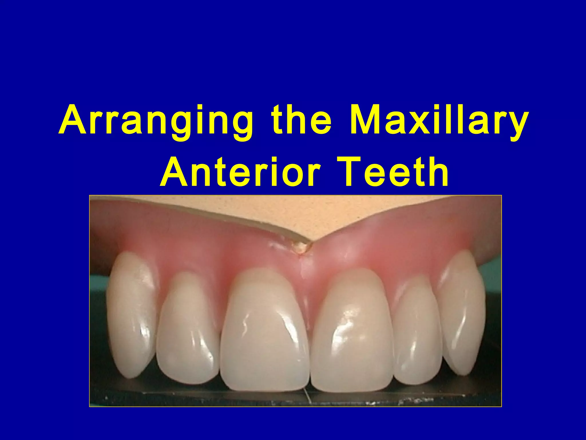 9. anterior teeth arrangement | PPT