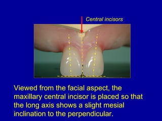 9. anterior teeth arrangement | PPT