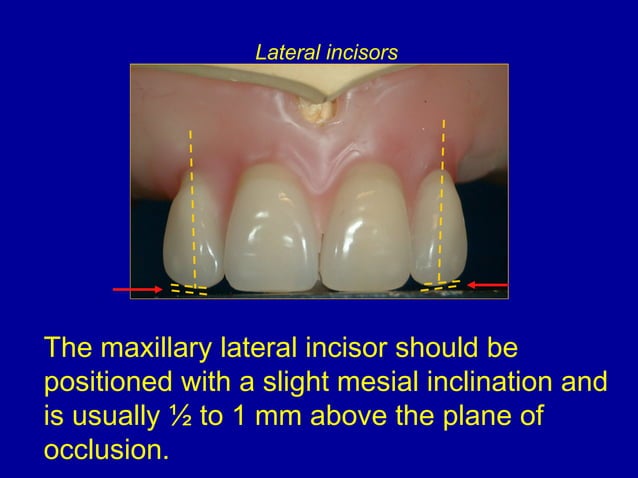 9. anterior teeth arrangement | PPT | Dental Health | Diseases and ...