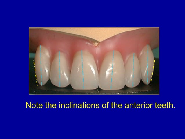 9. anterior teeth arrangement | PPT | Dental Health | Diseases and ...