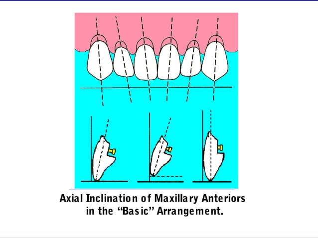 9. anterior teeth arrangement | PPT | Dental Health | Diseases and ...