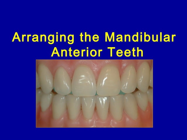 9. anterior teeth arrangement | PPT | Dental Health | Diseases and ...