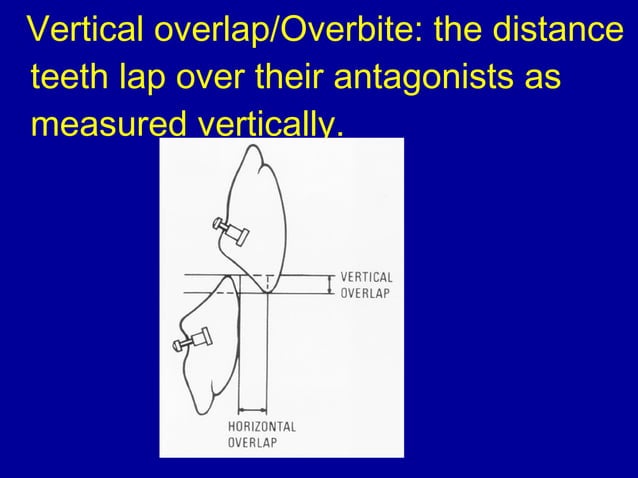 9. anterior teeth arrangement | PPT | Dental Health | Diseases and ...