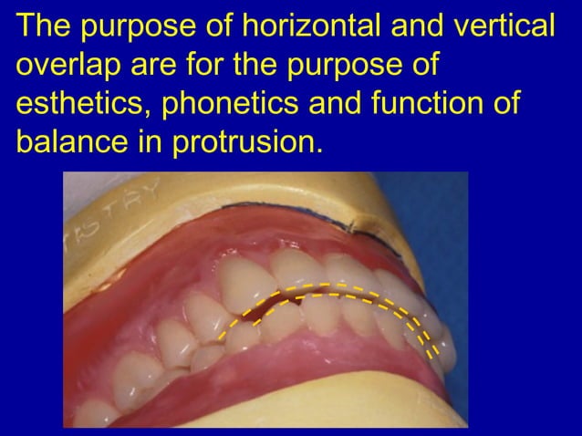 9. anterior teeth arrangement | PPT | Dental Health | Diseases and ...