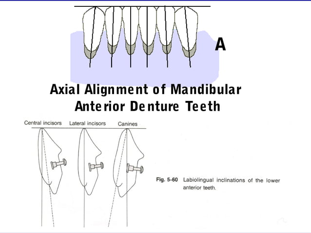 9. anterior teeth arrangement | PPT | Dental Health | Diseases and ...