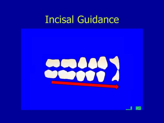 9. anterior teeth arrangement | PPT | Dental Health | Diseases and ...