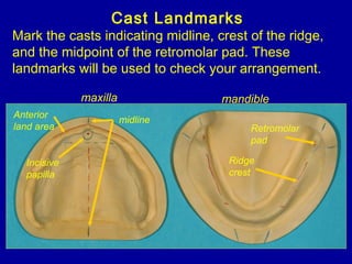 9. anterior teeth arrangement | PPT