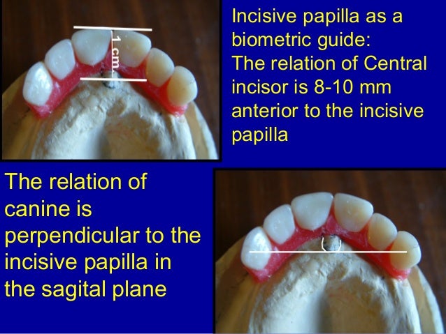 9. anterior teeth arrangement