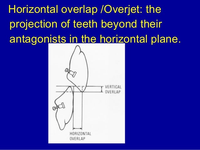 9. anterior teeth arrangement