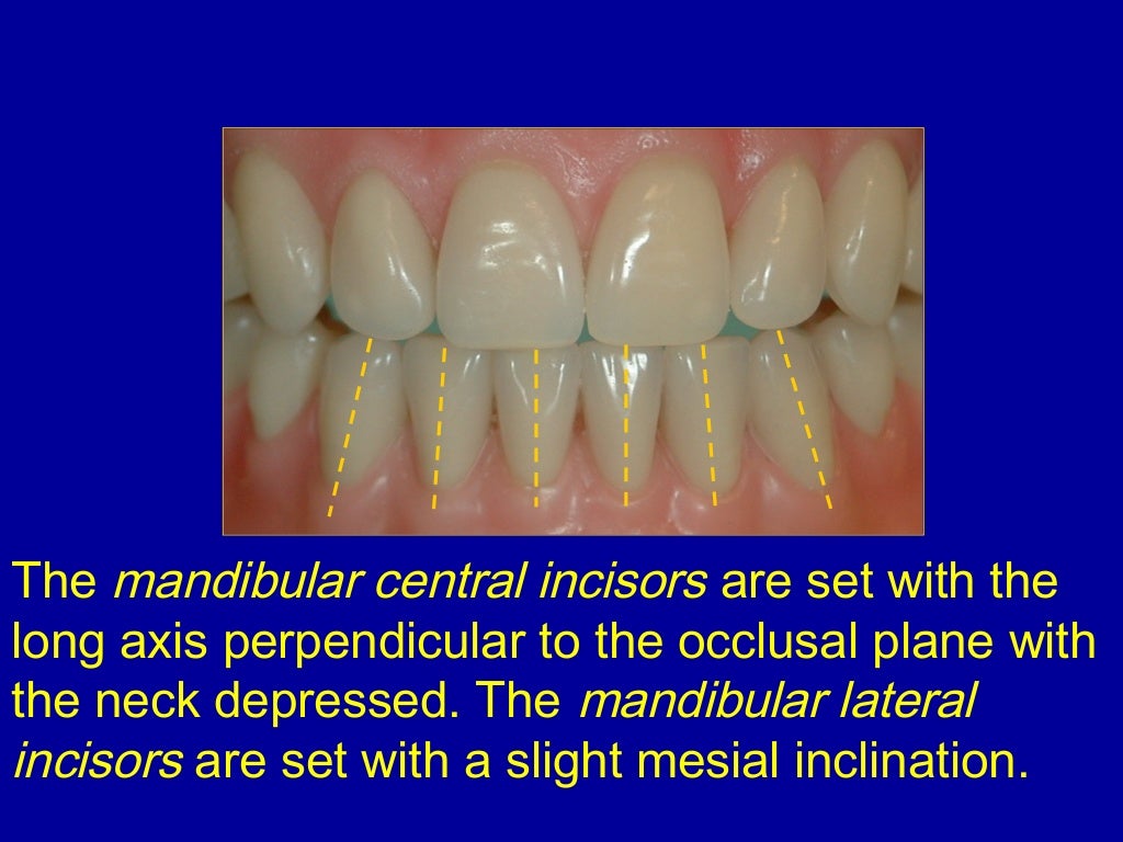 9. anterior teeth arrangement