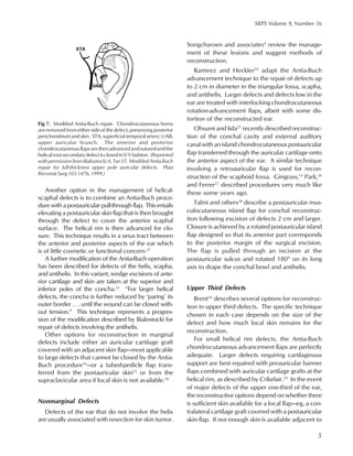 plastic surgery of the ear | PDF