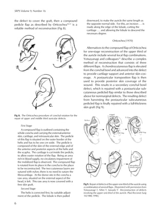 plastic surgery of the ear | PDF