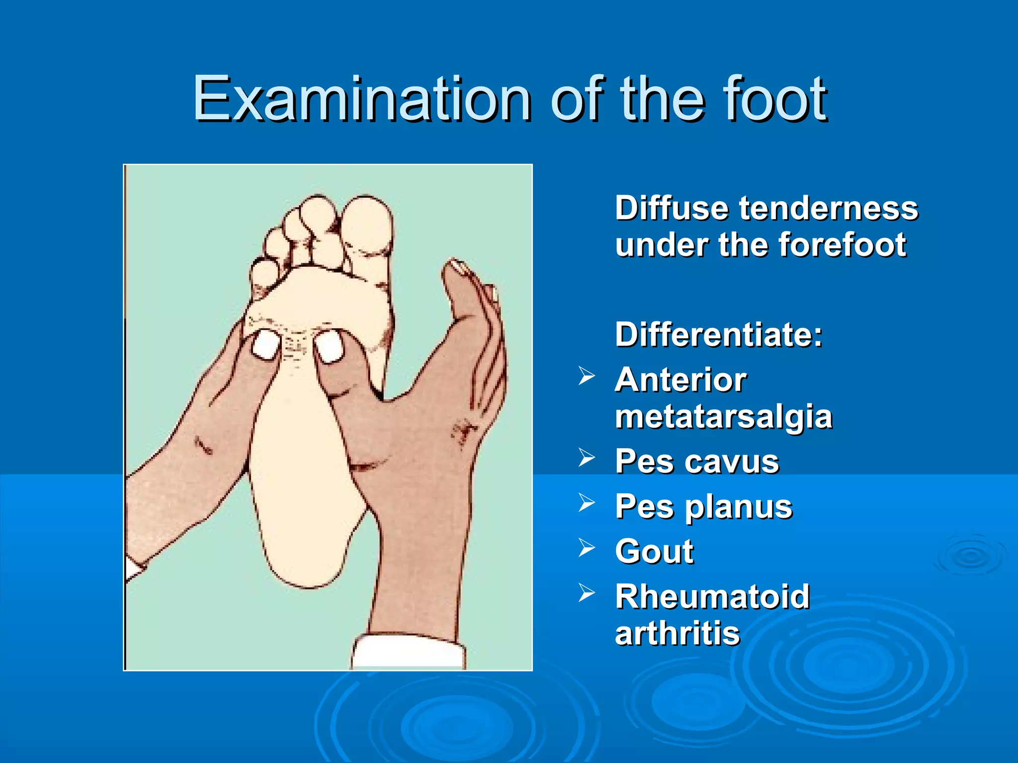 Deformities of the Foot | PPT